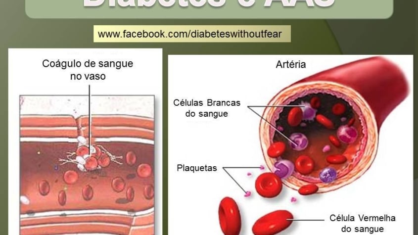 Diabetes e Aspirina | Diabeticool
